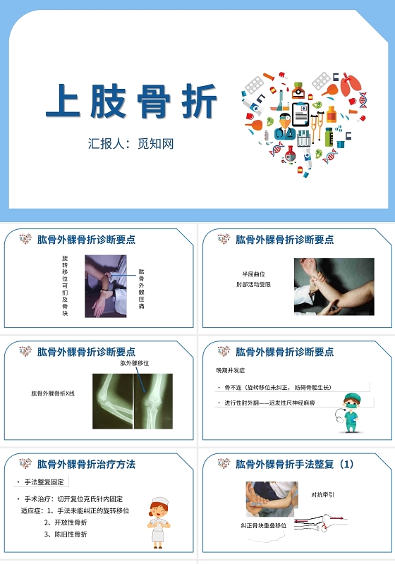 骨折护理查房PPT 骨折护理查房ppt模板下载 第3页 觅知网